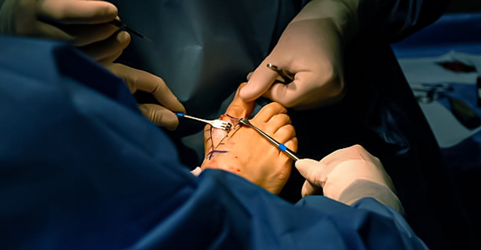 Foot and ankle doctors specialist | Clinic Brownsville RGV