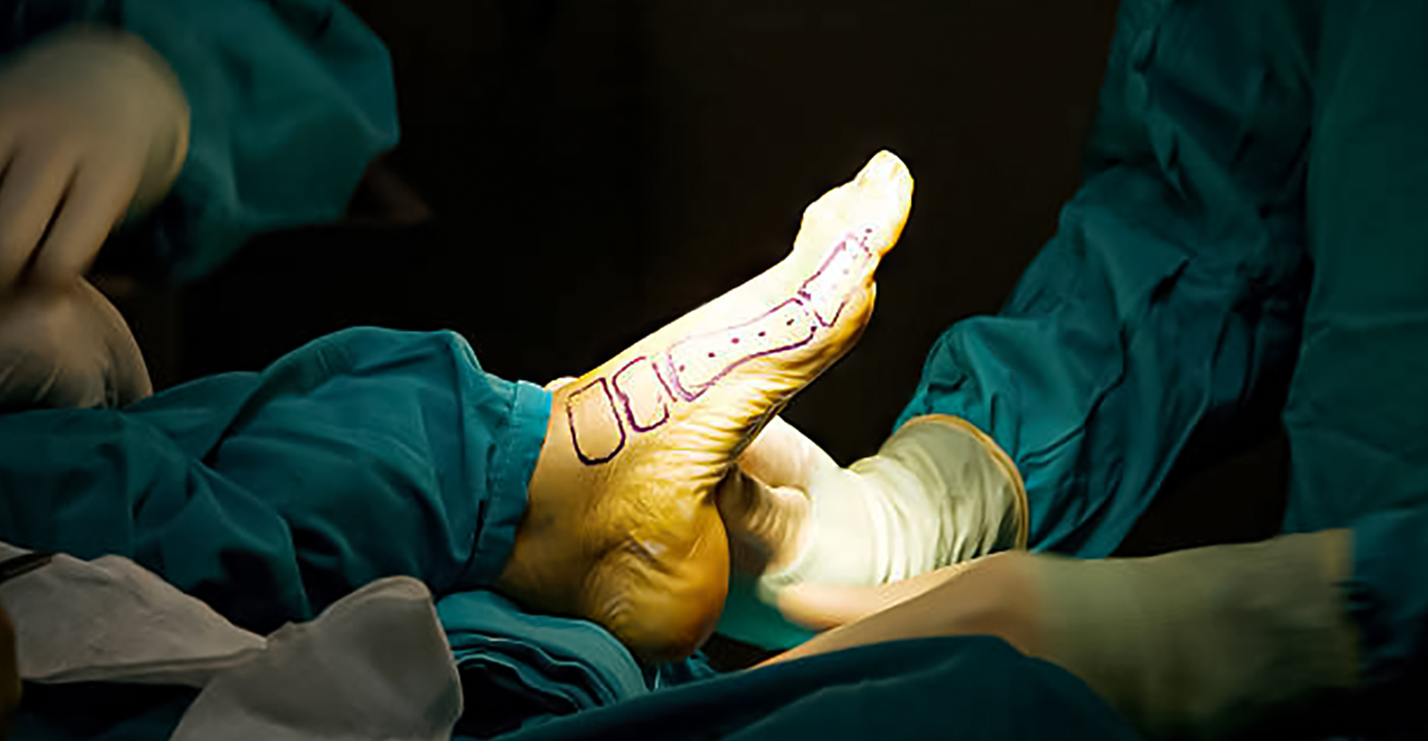 Foot and ankle doctors specialist | Clinic Brownsville RGV