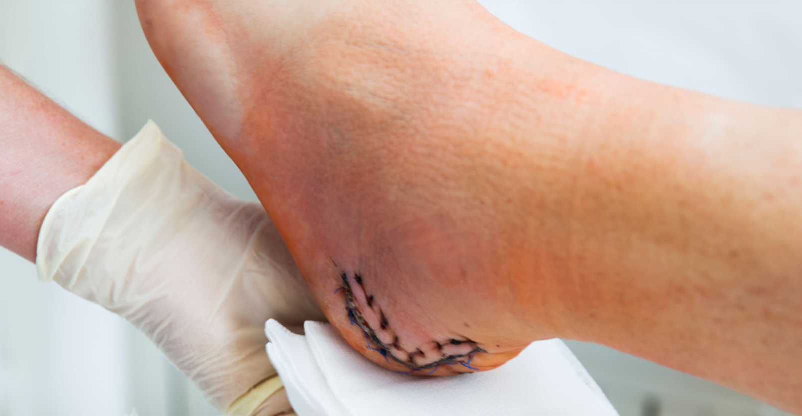 Foot and ankle doctors specialist | Clinic Brownsville RGV